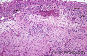 Piel – Fish Histopathology